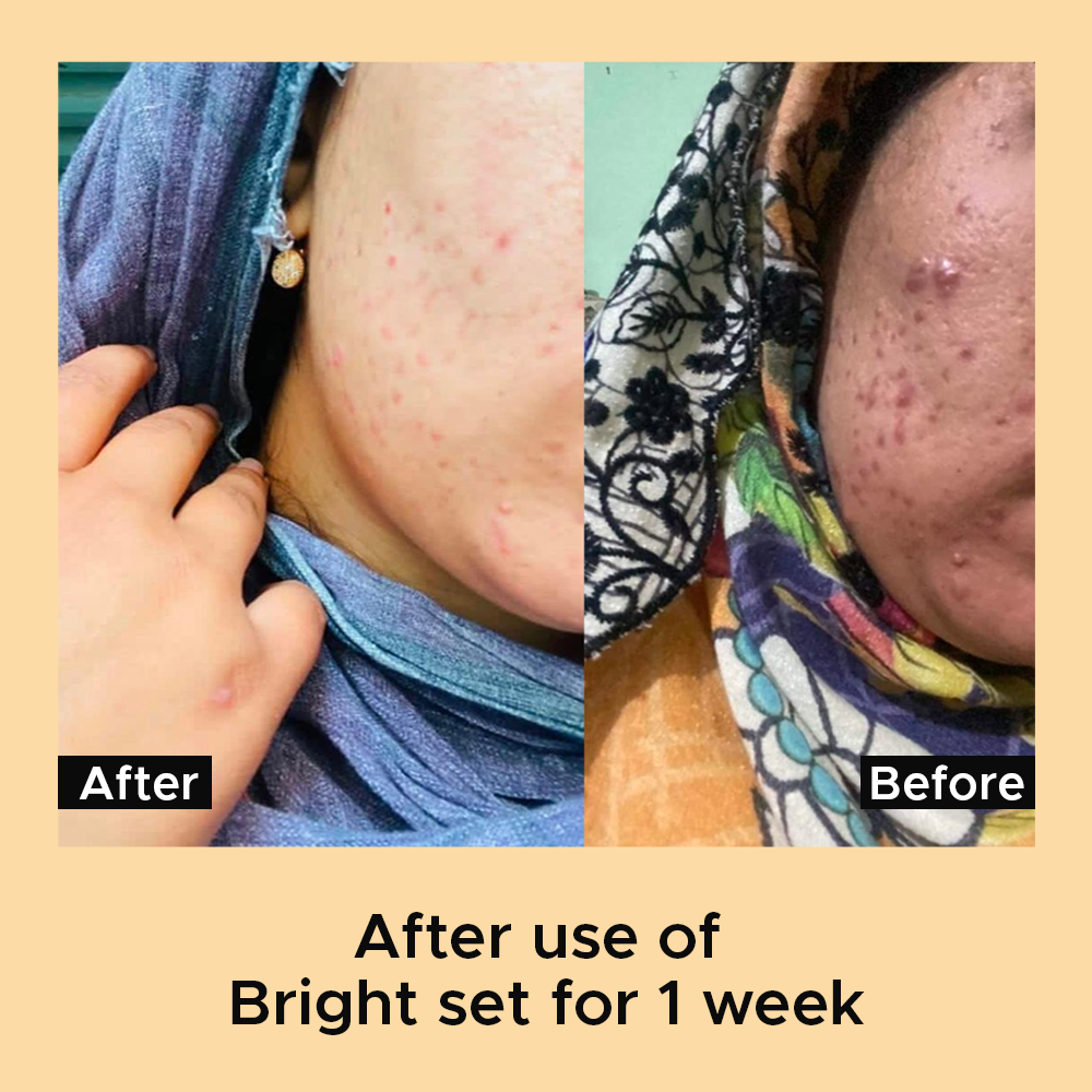 The Bright Set – uraprapk